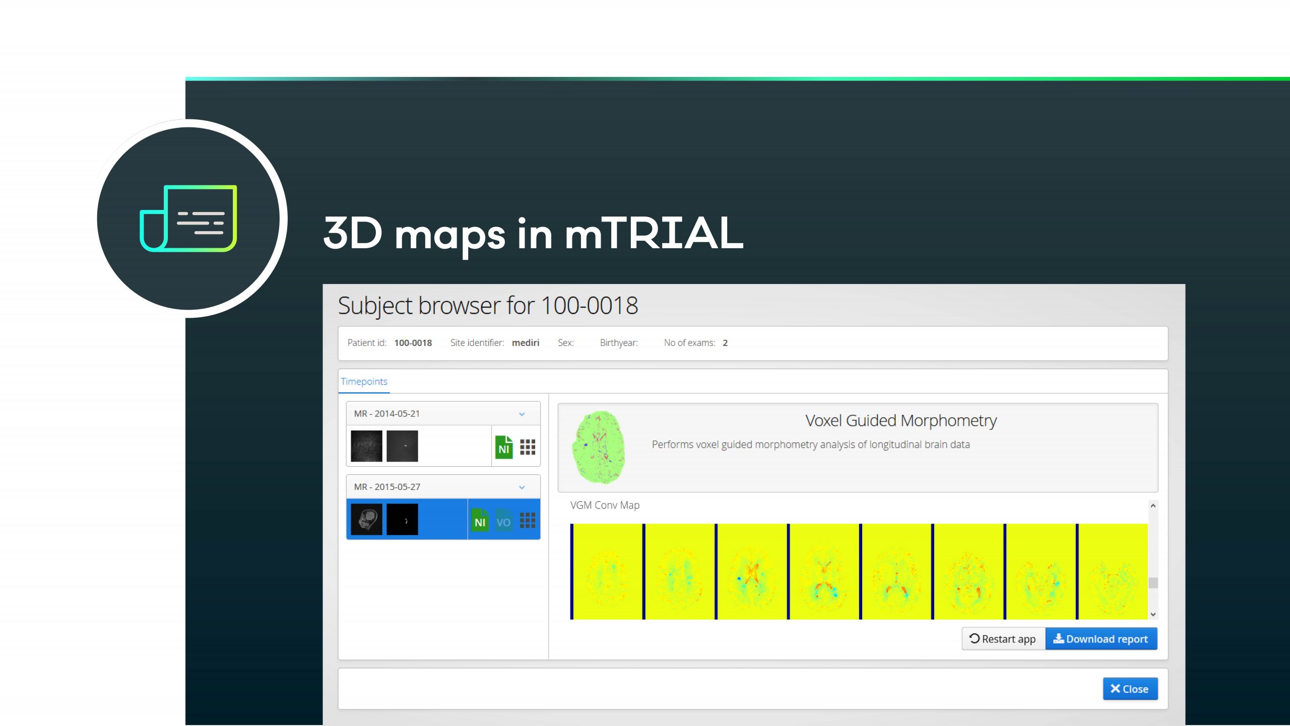 High-speed upgrade for brain mapper II – KI4MS