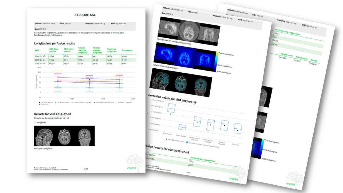 ASL perfusion imaging