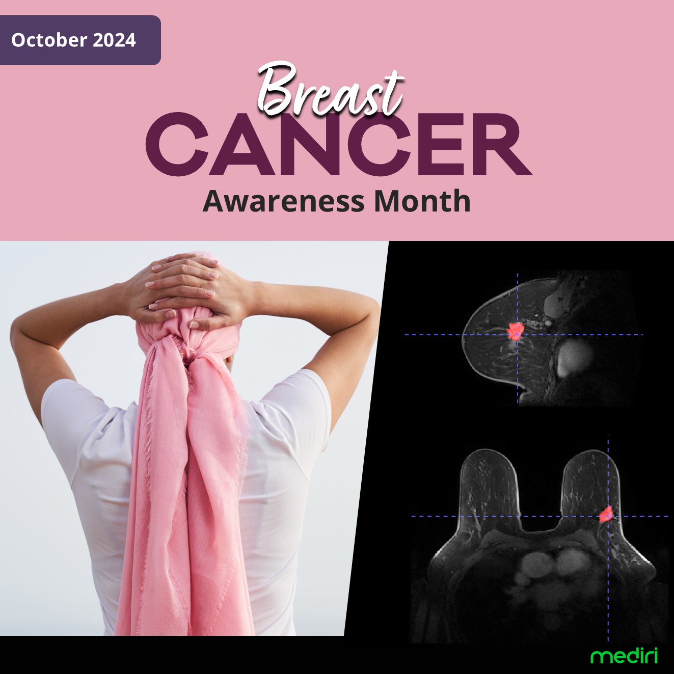 Breast Cancer Awareness Month